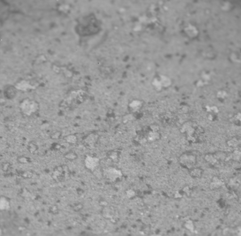 Life on Mars? Odd rings and spots tantalize scientists